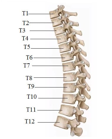 ¿Qué es una hernia discal y cómo prevenirla? – Clinica Fixen